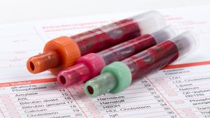 Low White Blood Cell Count: What It Means, When to Worry, and How to ...